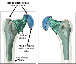 Use Abaqus to Simulate Additive Manufacturing: Printing a Hip Implant