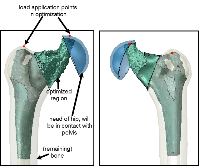 Use Abaqus to Simulate Additive Manufacturing: Printing a Hip Implant